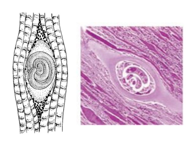 Overview of Intestinal Nematodes: Types, Life Cycle, and Diseases | PPT