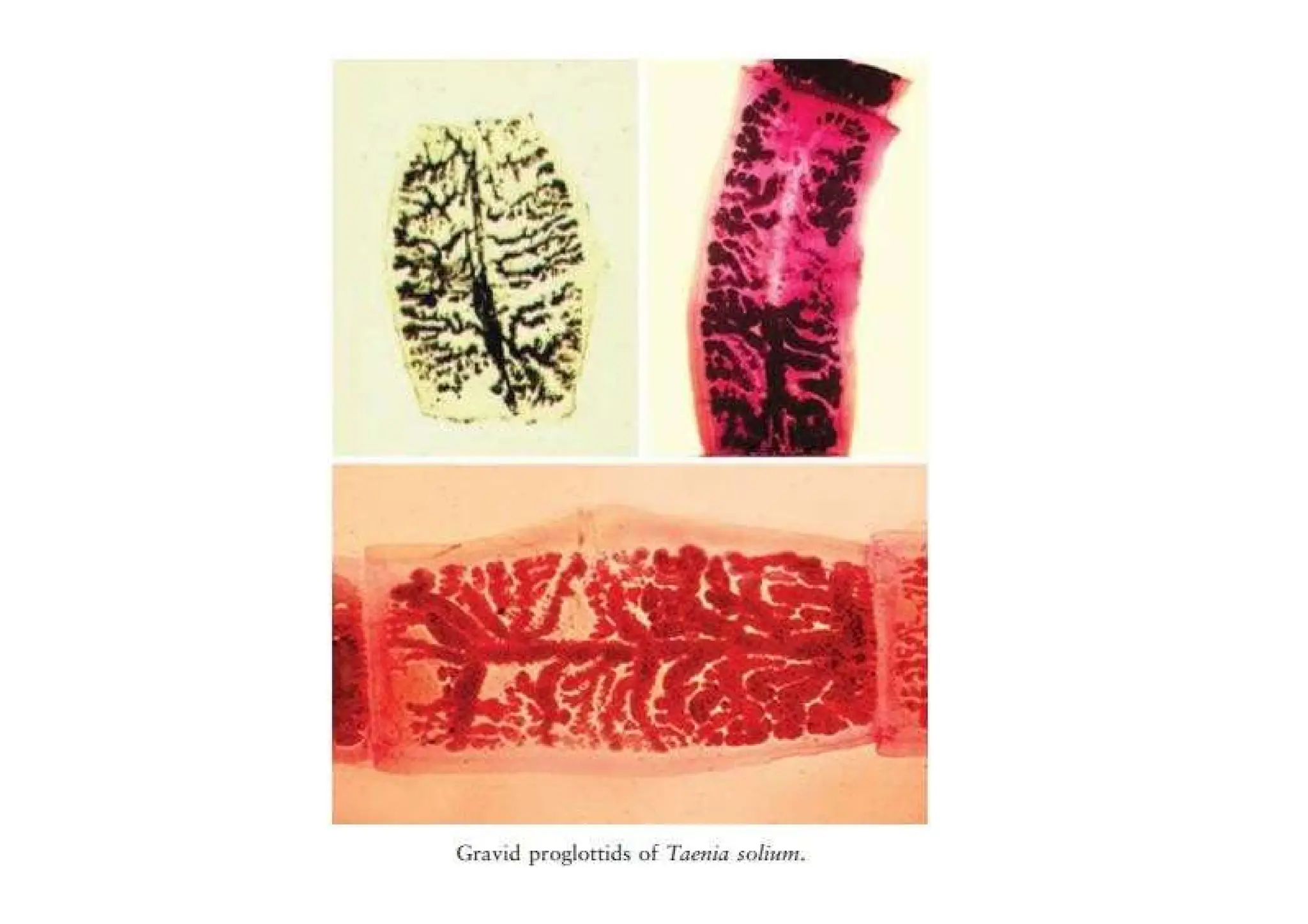 “Overview of Intestinal Cestodes: Types, Life Cycle, and Diseases” | PDF