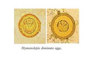 “Overview of Intestinal Cestodes: Types, Life Cycle, and Diseases” | PPT