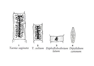 “Overview of Intestinal Cestodes: Types, Life Cycle, and Diseases” | PPT