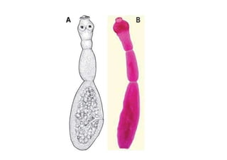 “Overview of Intestinal Cestodes: Types, Life Cycle, and Diseases” | PDF