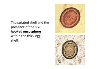 “Overview of Intestinal Cestodes: Types, Life Cycle, and Diseases” | PPT