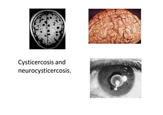 “Overview of Intestinal Cestodes: Types, Life Cycle, and Diseases” | PPT