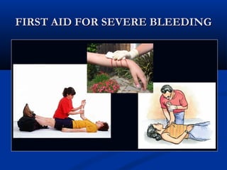 Lab 1 safety first aid | PPT