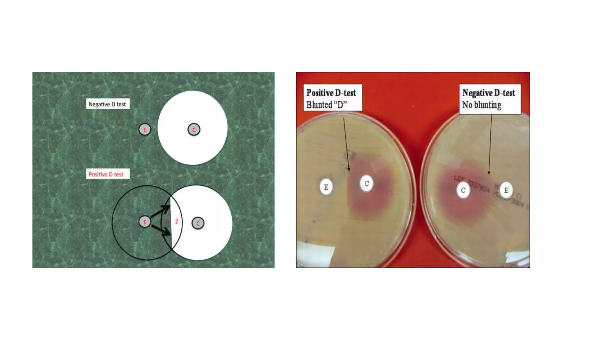 Inducible Clindamycin Resistance Test | PPTX