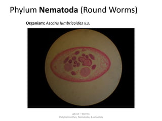 Lab 10 – worms | PPTX | Biological Sciences | Science