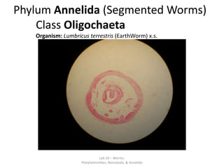 Lab 10 – worms | PPTX | Biological Sciences | Science