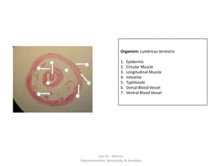 Lab 10 – worms | PPTX | Biological Sciences | Science