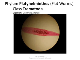 Lab 10 – worms | PPTX