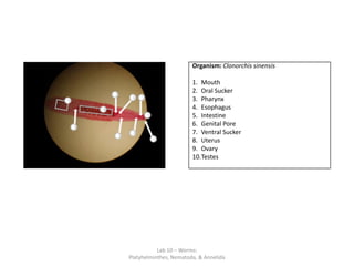 Lab 10 – worms | PPTX | Biological Sciences | Science