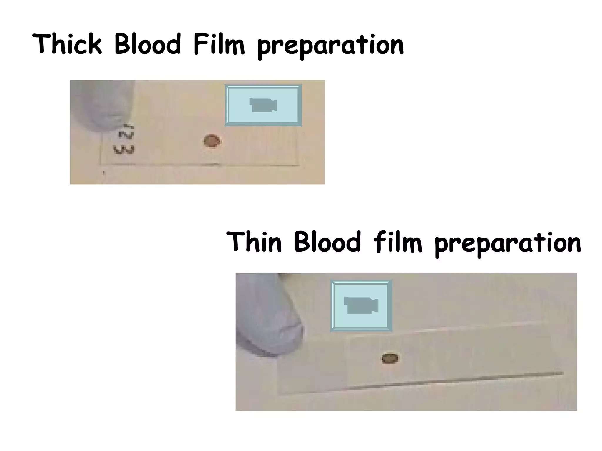 Lab 12 blood film | PPT
