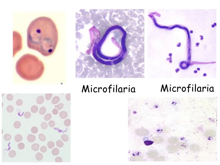 Lab 12 blood film