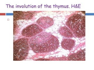 (thymus, lymph node) xxxxxxxxxxxxxxxxxxxx | PPTX