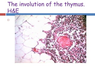 (thymus, lymph node) xxxxxxxxxxxxxxxxxxxx | PPTX