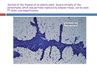 (thymus, lymph node) xxxxxxxxxxxxxxxxxxxx | PPTX