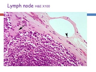(thymus, lymph node) xxxxxxxxxxxxxxxxxxxx | PPTX
