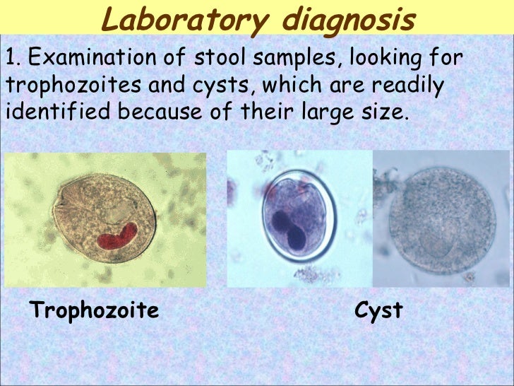 Lab 13 balantidiasis