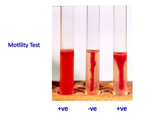 lab 14- Ecoli & Kleb 22. enterobacteriace pptx | PPT