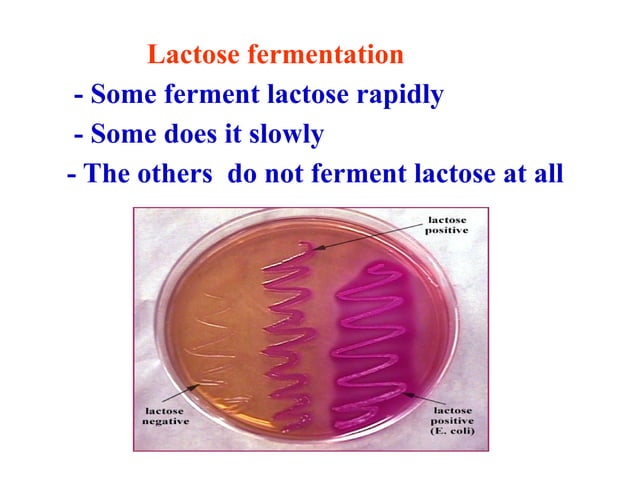 lab 14- Ecoli & Kleb 22. enterobacteriace pptx | PPT