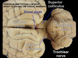Superior Colliculus Sheep Brain