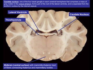 Caudate Nucleus Sheep Brain