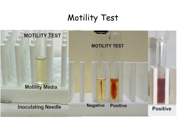 Enterobacter Aerogenes Motility Test Table S1. IMViC Test Result Of