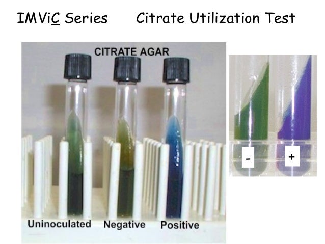 بكتريا عملي