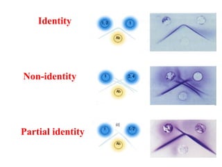 lab 20 - serological immunoassay medical students | PPT