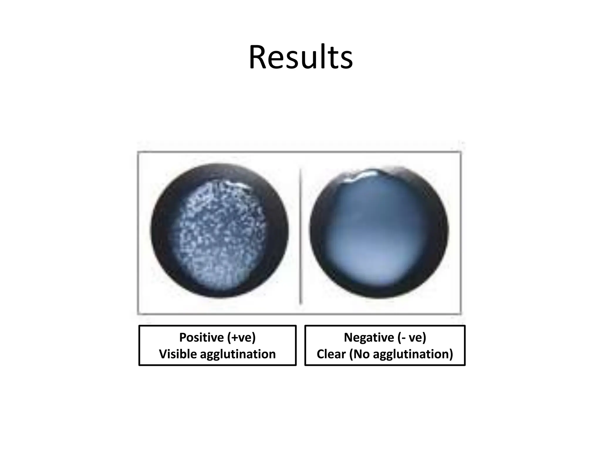 Lab 2 rapid and direct serological test.pptx