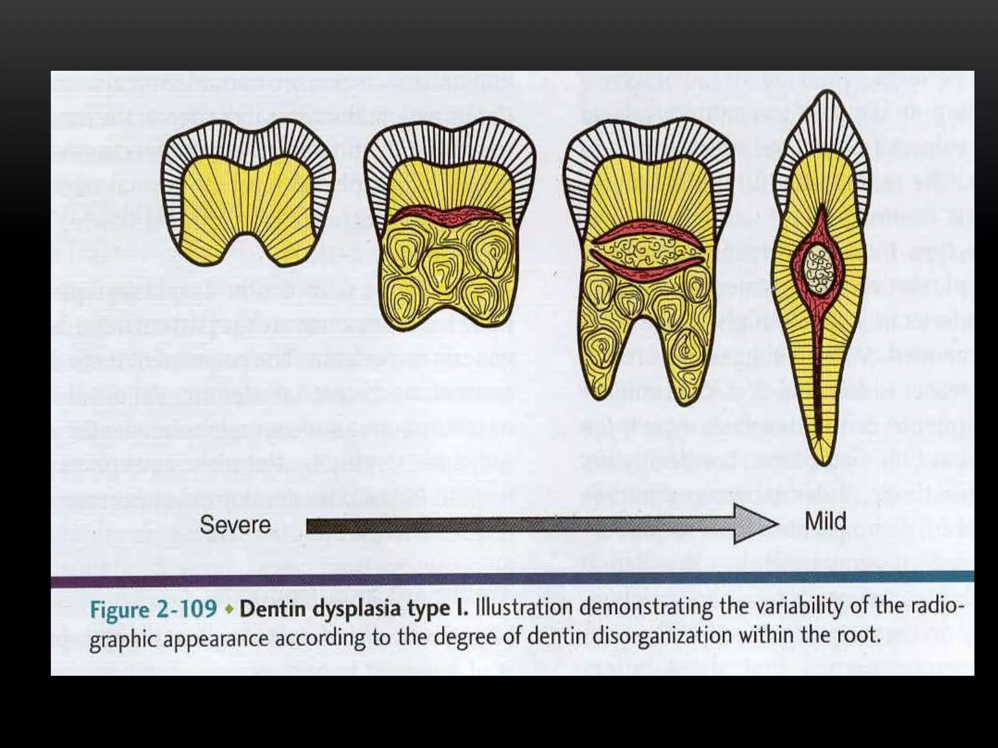 Lab 3 developmental defect teeth dina | PPTX