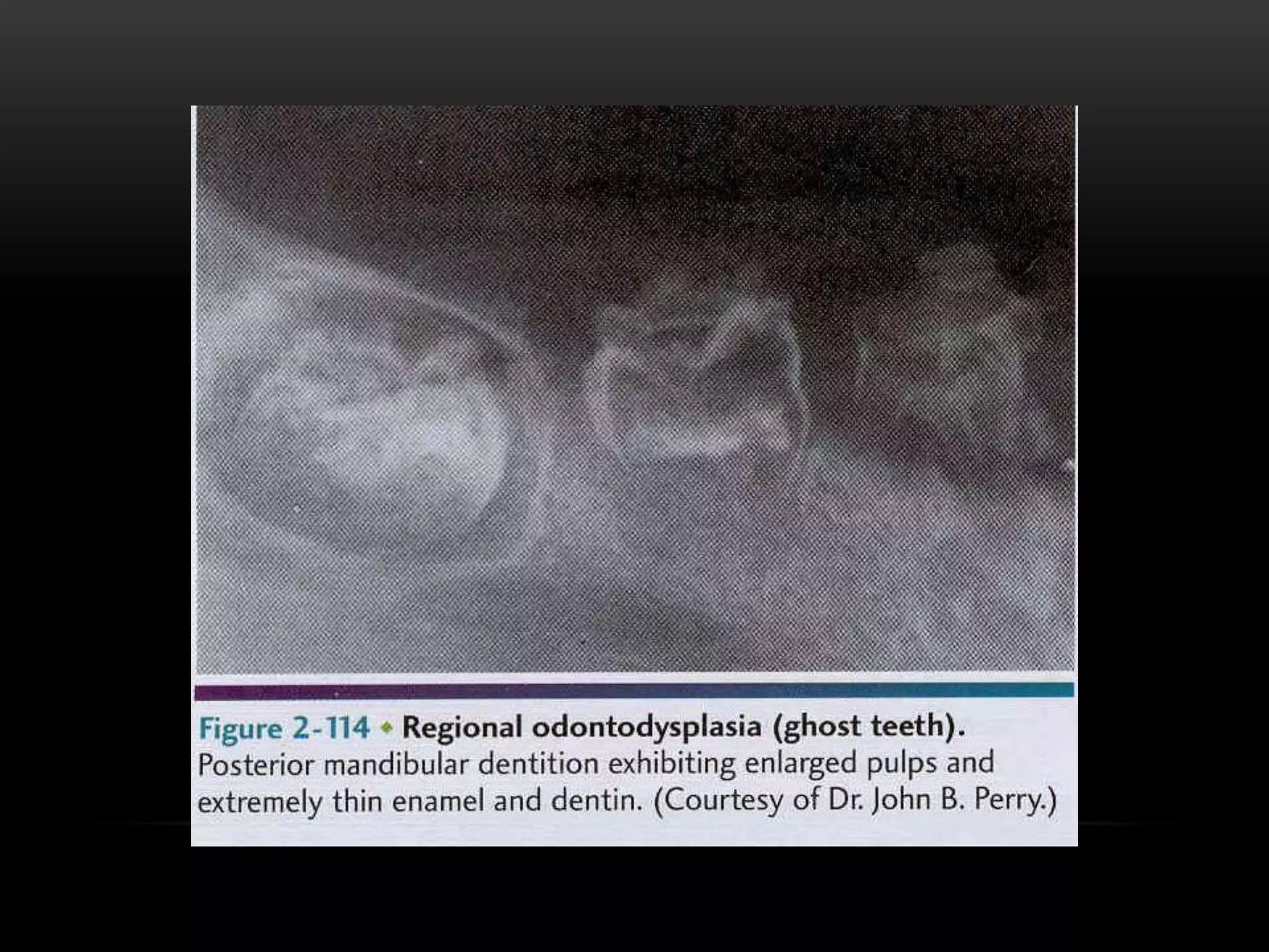 Lab 3 developmental defect teeth dina | PPTX