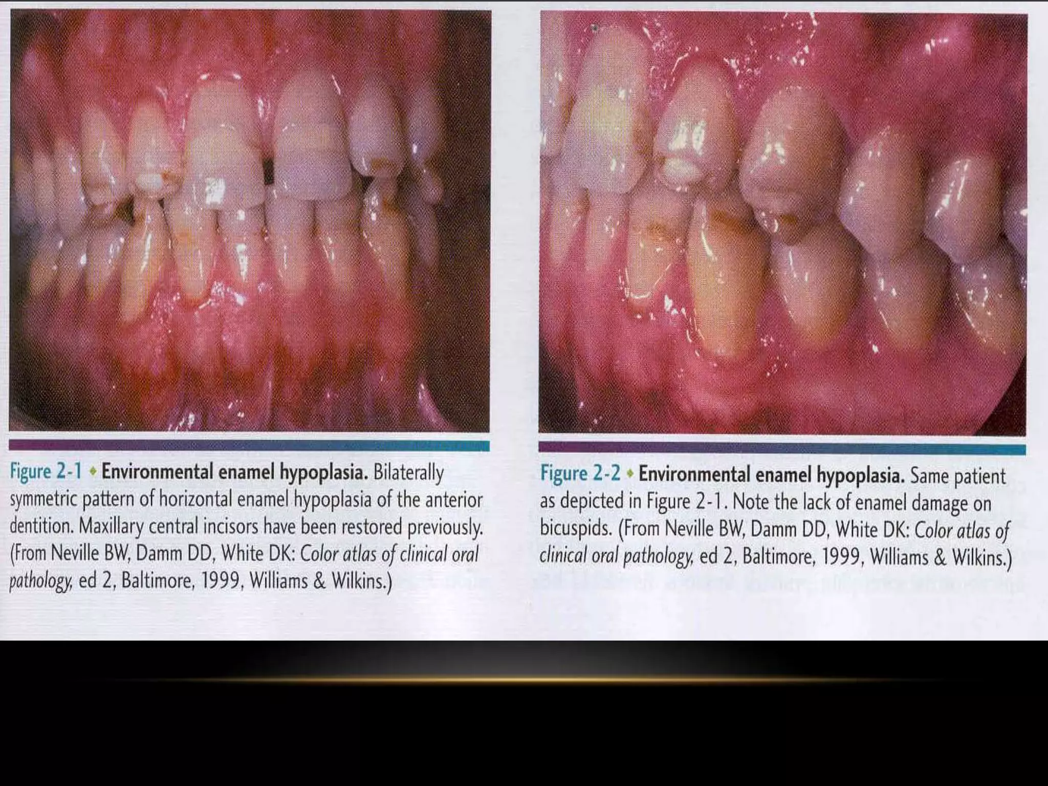 Lab 3 developmental defect teeth dina | PPTX