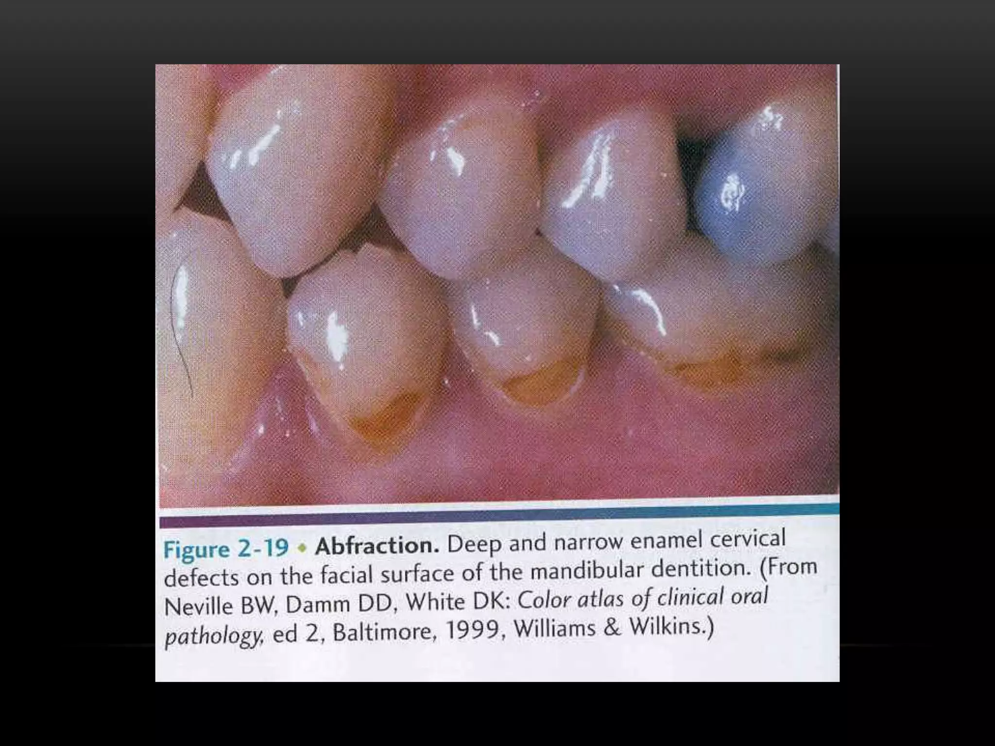 Lab 3 developmental defect teeth dina | PPTX
