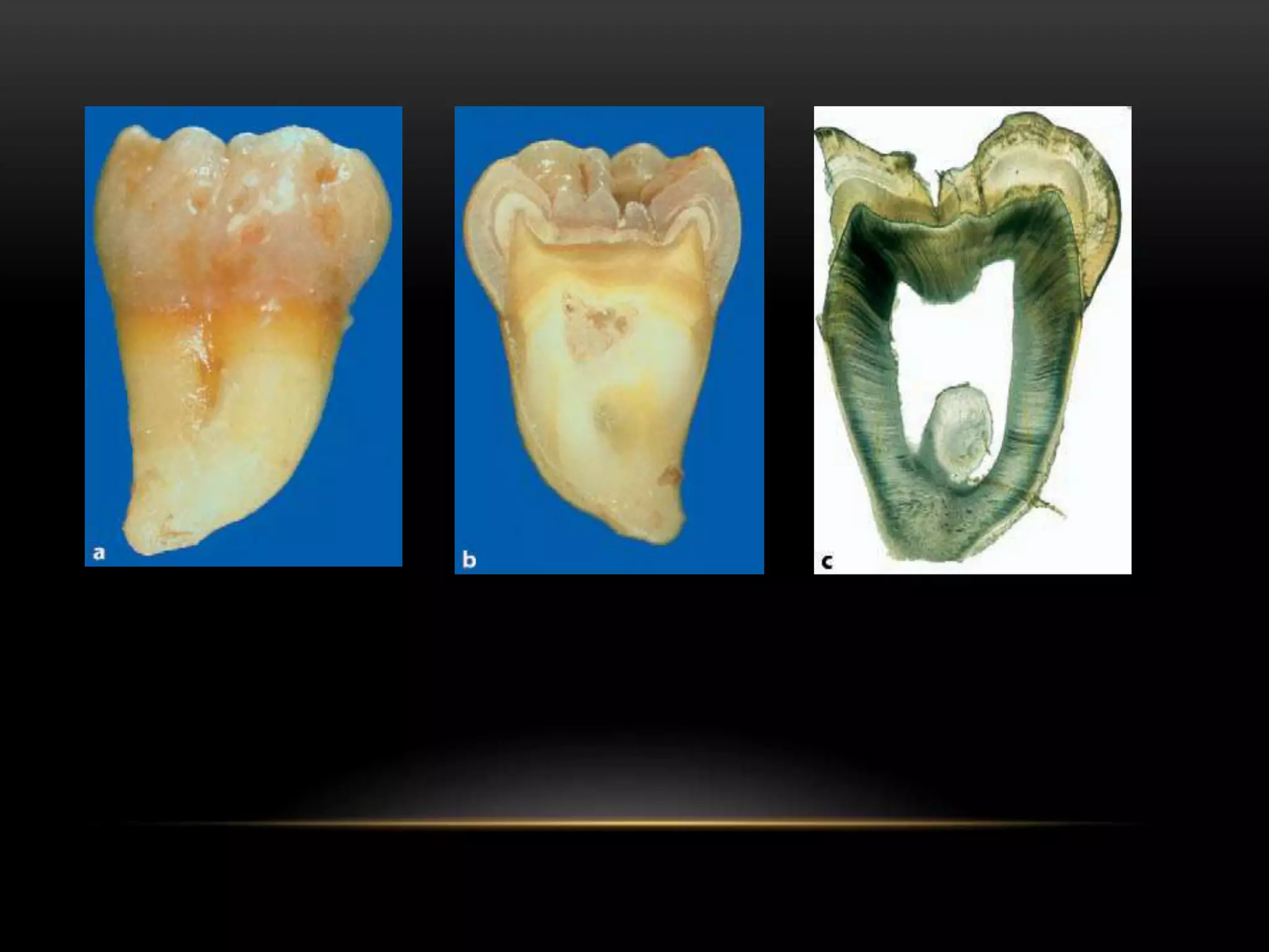 Lab 3 developmental defect teeth dina | PPTX