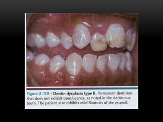 Lab 3 developmental defect teeth dina | PPTX