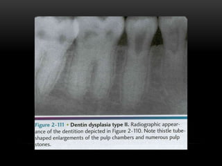 Lab 3 developmental defect teeth dina | PPTX