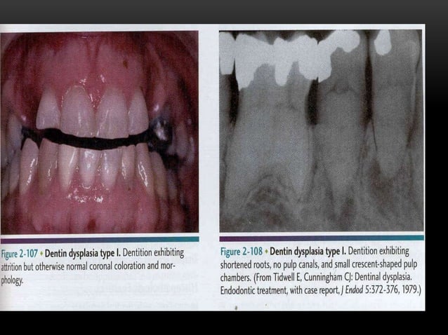 Lab 3 developmental defect teeth dina | PPT