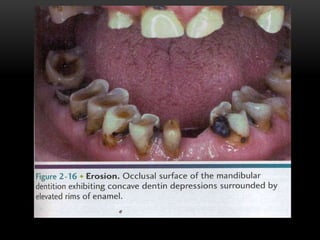 Lab 3 developmental defect teeth dina | PPTX