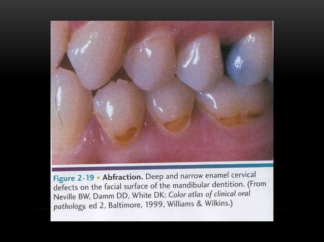 Lab 3 developmental defect teeth dina | PPT