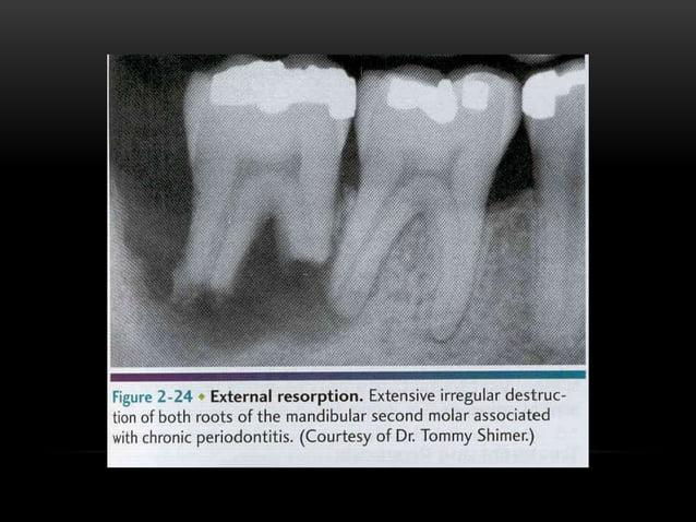 Lab 3 developmental defect teeth dina | PPT