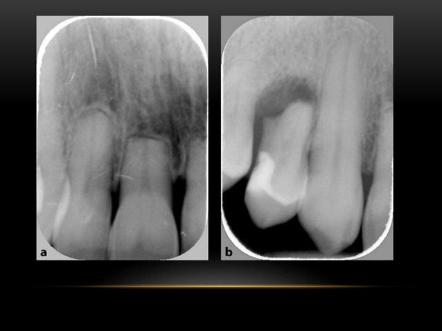 Lab 3 developmental defect teeth dina | PPT