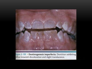 Lab 3 developmental defect teeth dina | PPTX