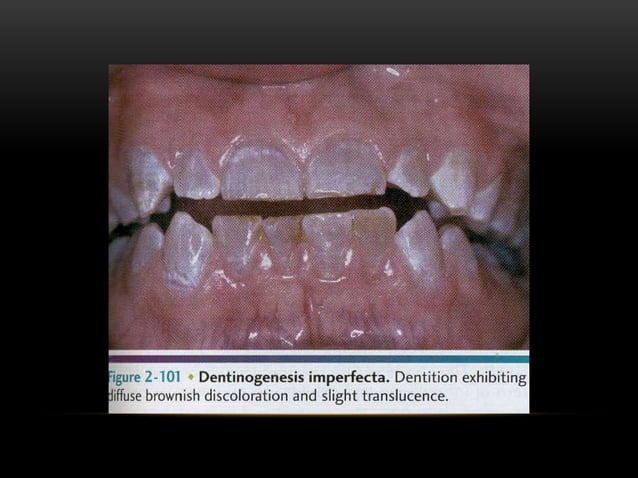 Lab 3 developmental defect teeth dina | PPT