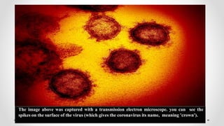 virus observation (lab diagnosis ).pptx
