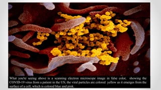 virus observation (lab diagnosis ).pptx