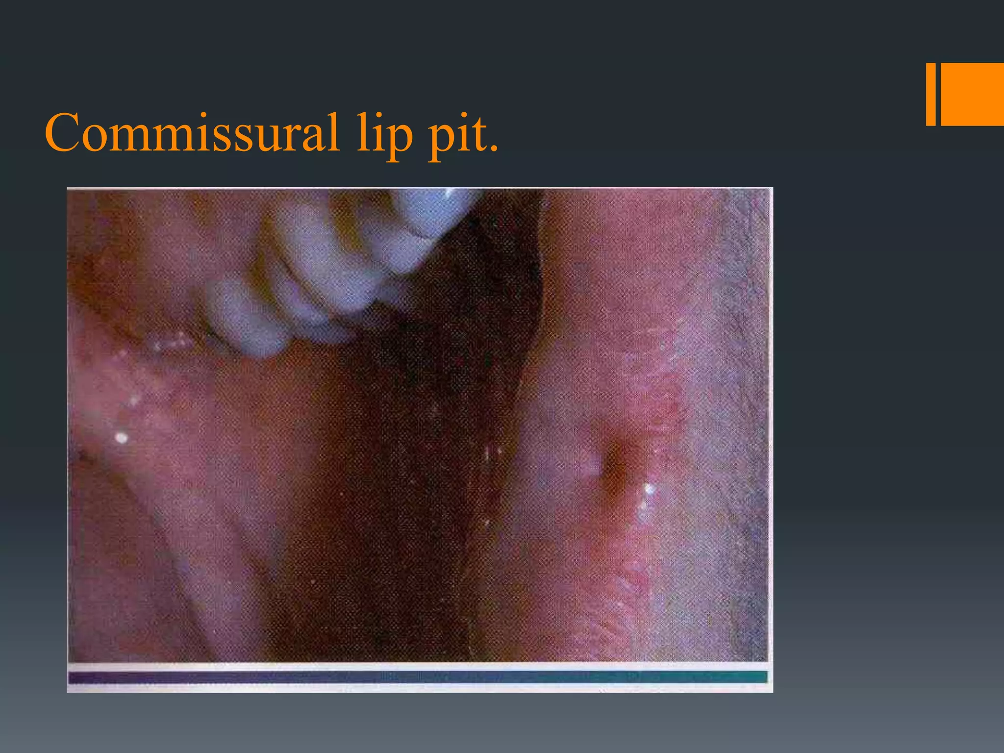 Lab 4 developmental defect soft tissue dina patho | PPTX
