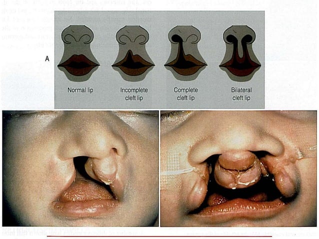 Lab 4 developmental defect soft tissue dina patho | PPT