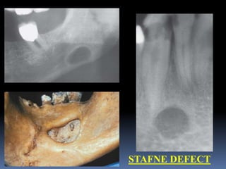 Lab 5 dina patho | PPTX