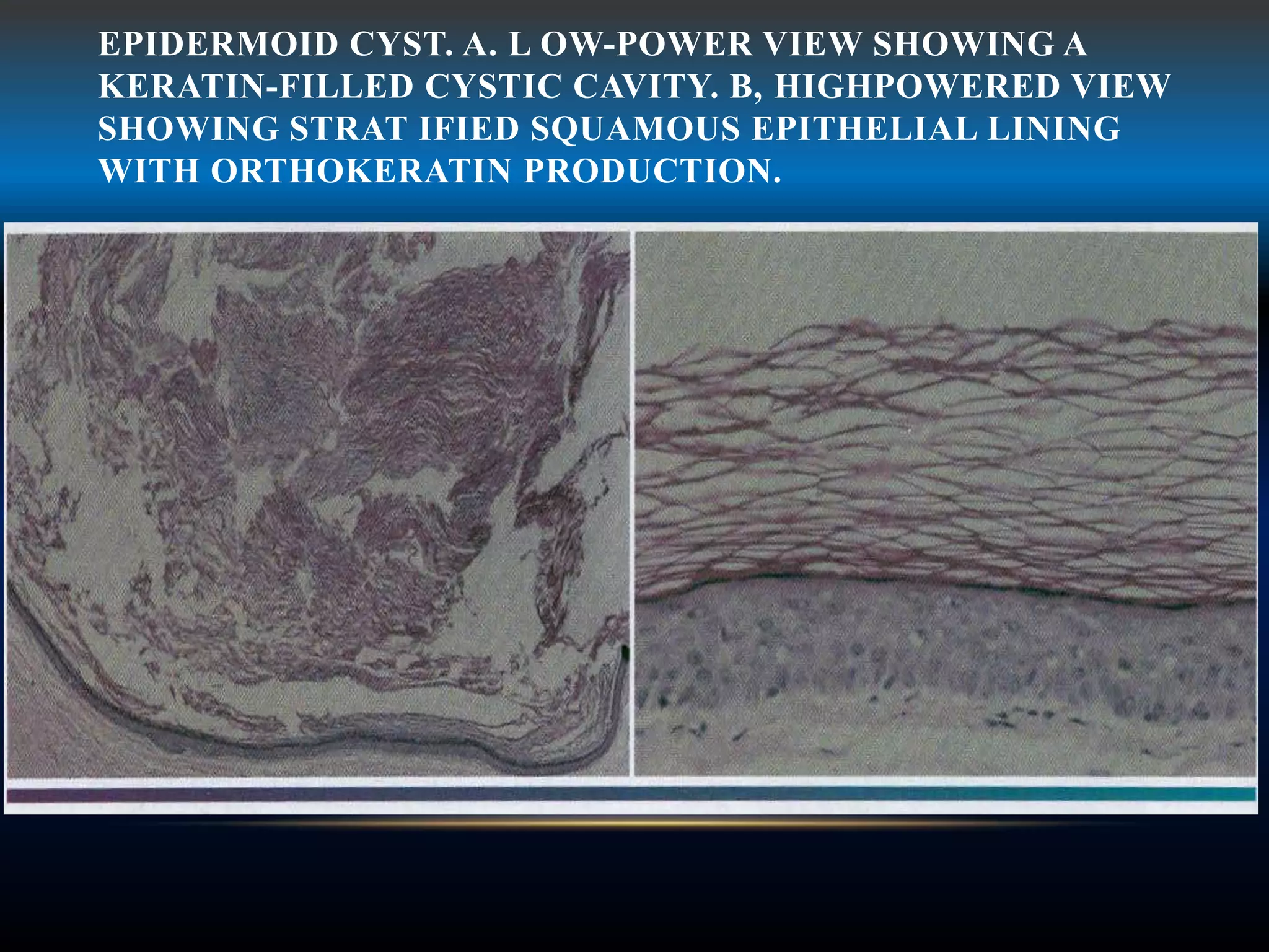 Lab 6 developmental cyst | PPTX