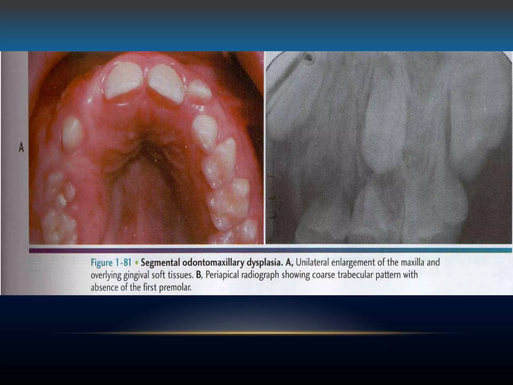 Lab 6 developmental cyst | PPTX